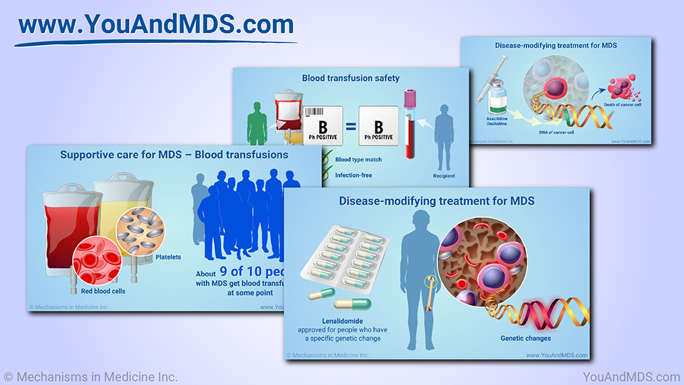 Slide Show - Management and Treatment of MDS